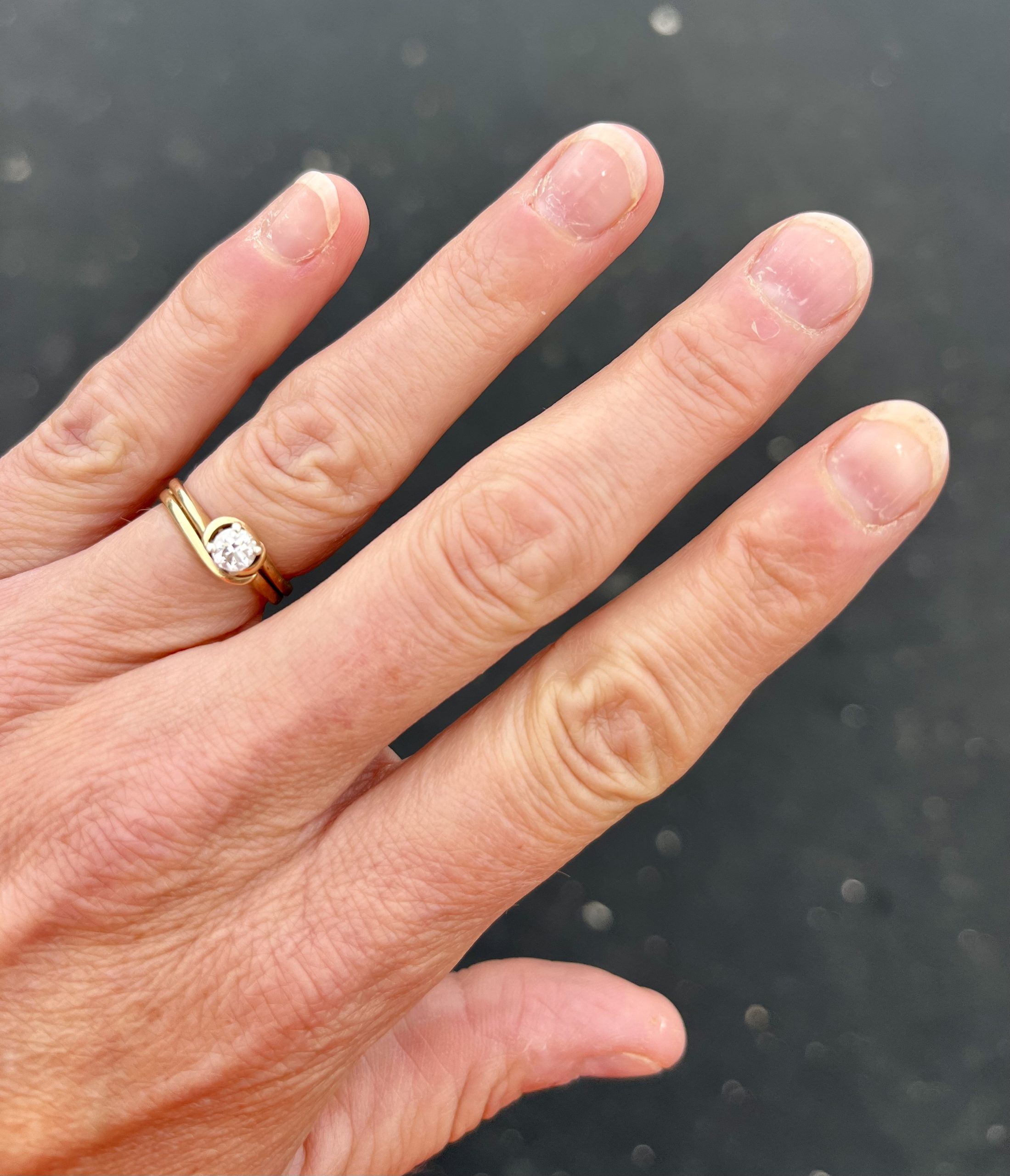 A Real Nail Biter: 4 Unexpected Lessons on Breaking Bad Habits ...