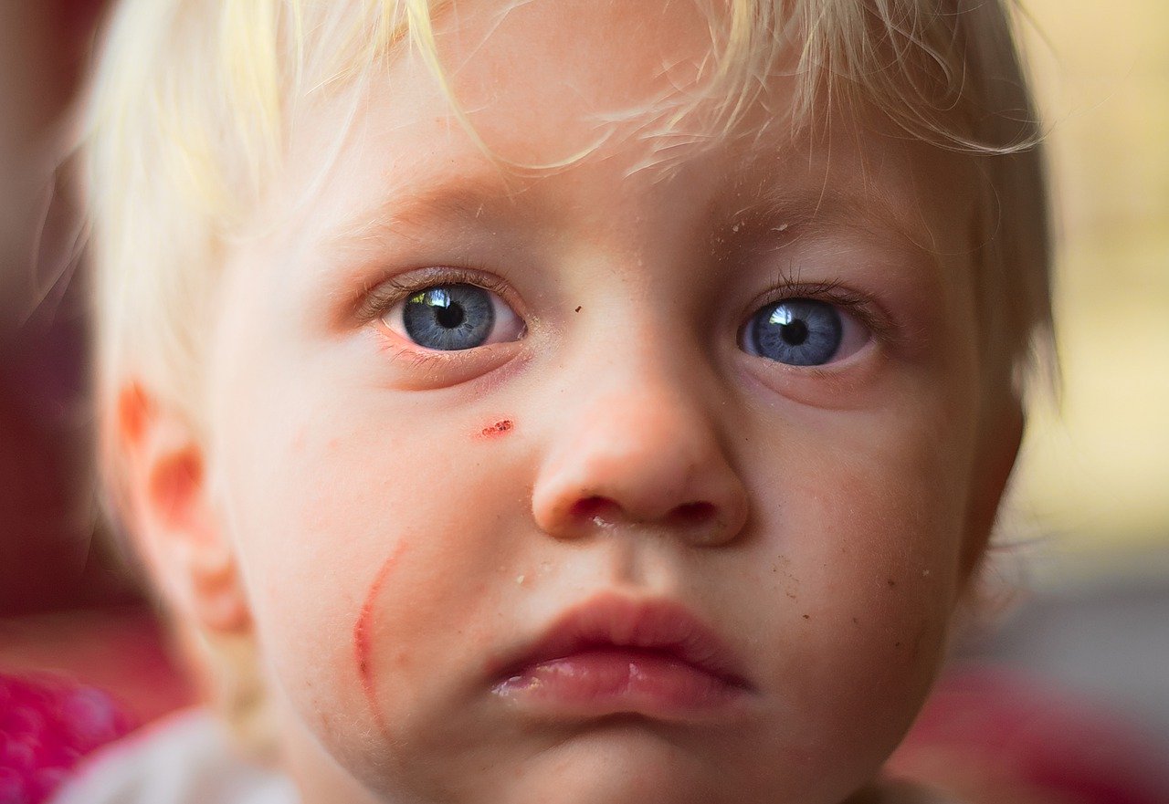 A New Look at Scars | Crossmap Blogs